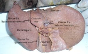 Liver Anatomy & Physiology - The Operative Review Of Surgery
