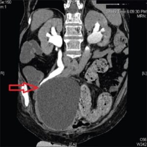 Lymphatic Pathology - The Operative Review Of Surgery