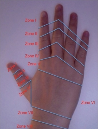 Hand Injury - The Operative Review Of Surgery